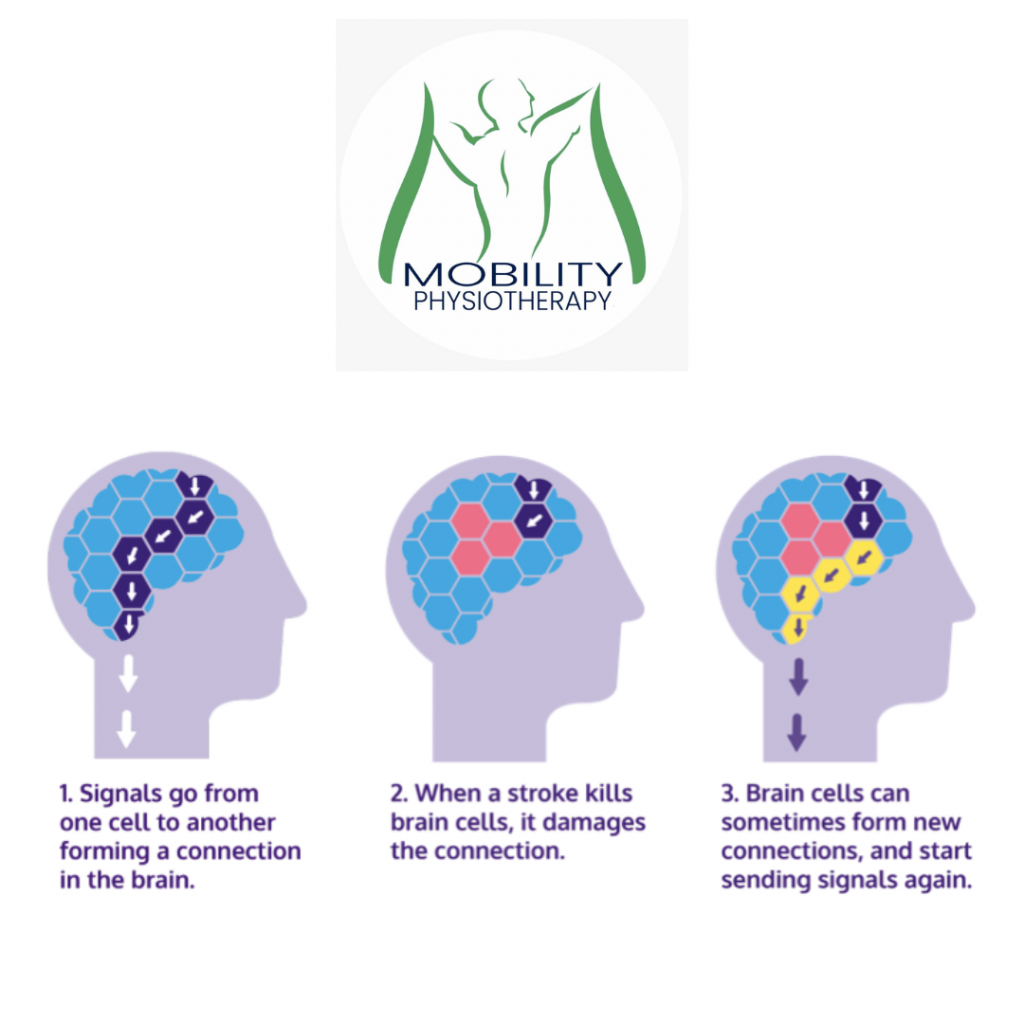 Recovery after Stroke » Mobility Physiotherapy Ltd